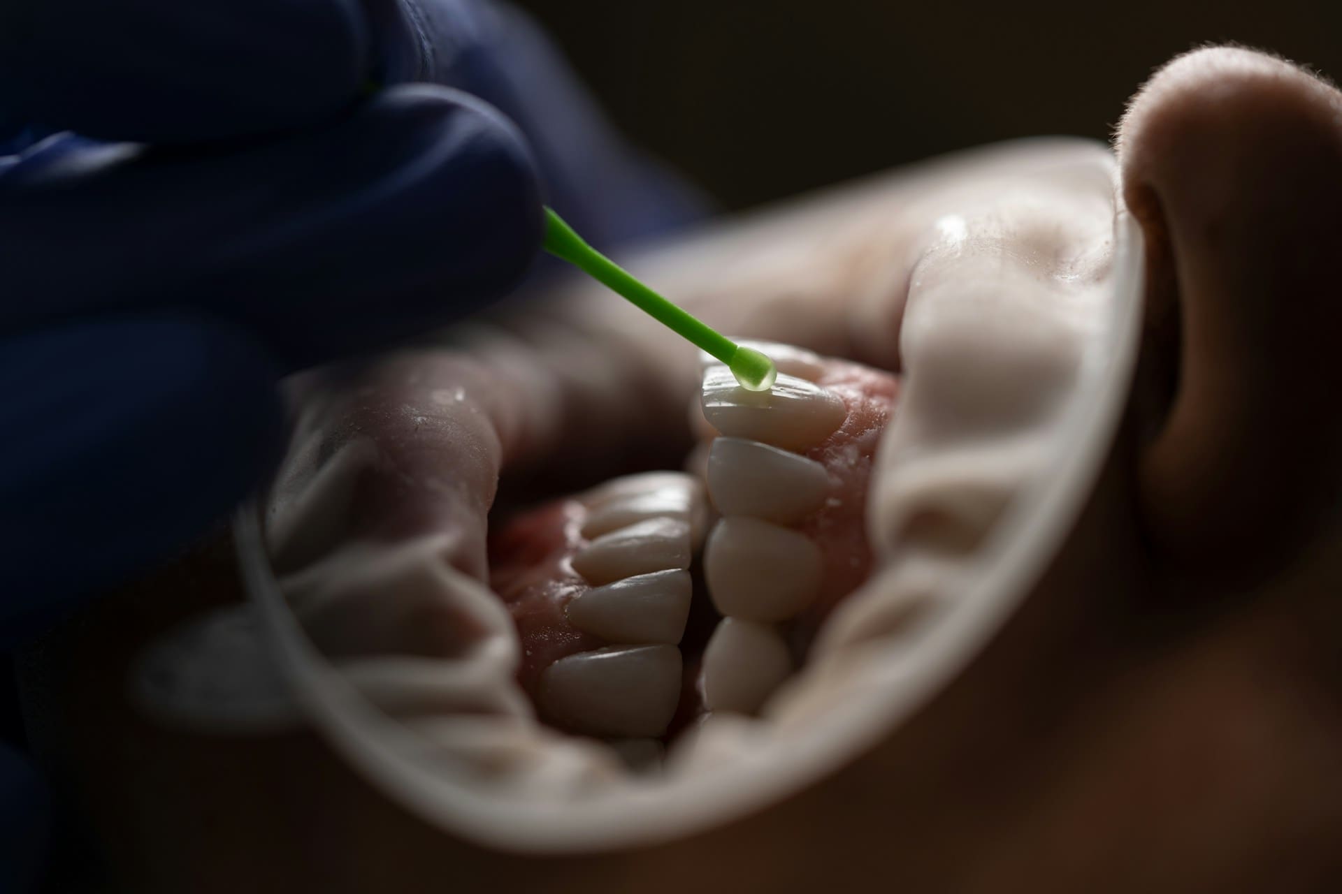 Truth and Facts About Soft Teeth: Myths, Causes, and Solutions